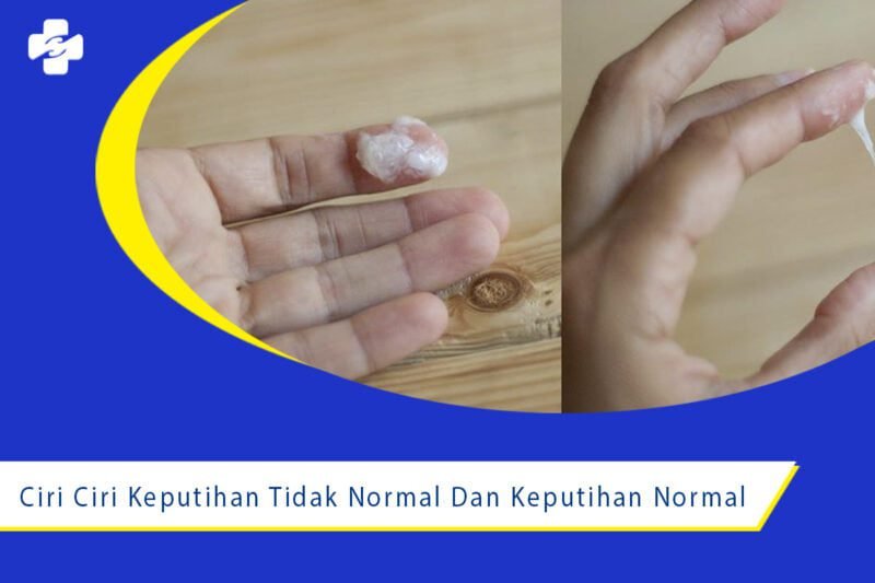 Ciri Keputihan Tidak Normal Dan Keputihan Normal | Klinik Utama Apollo