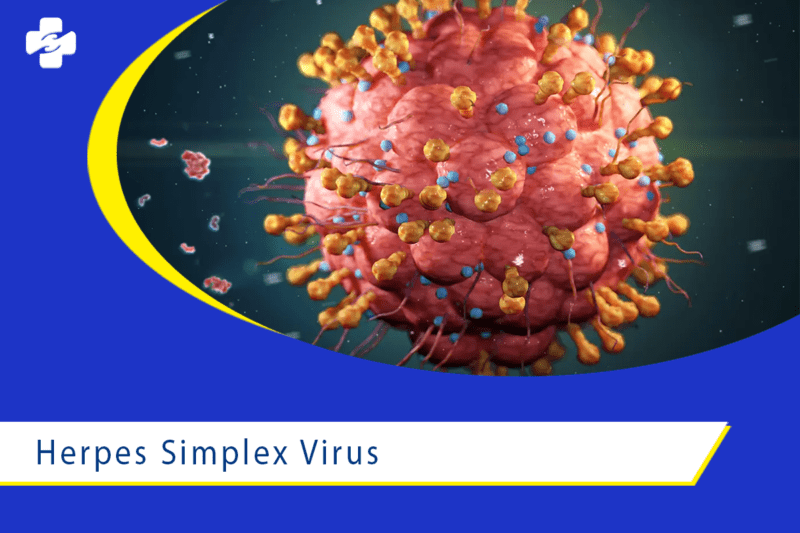Fakta Singkat Herpes Simplex Virus | Klinik Utama Apollo