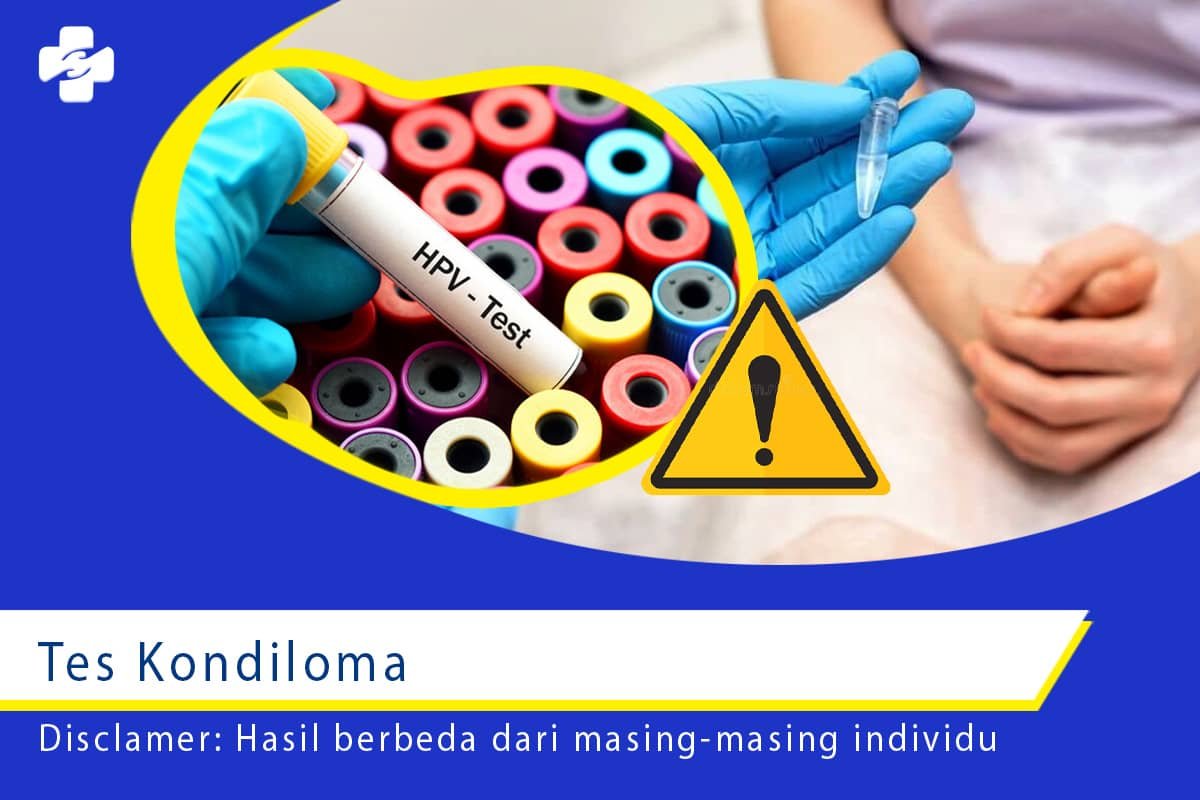 Tes Kondiloma: Mengapa Penting dan Apa Saja Jenisnya? | Klinik Utama Apollo