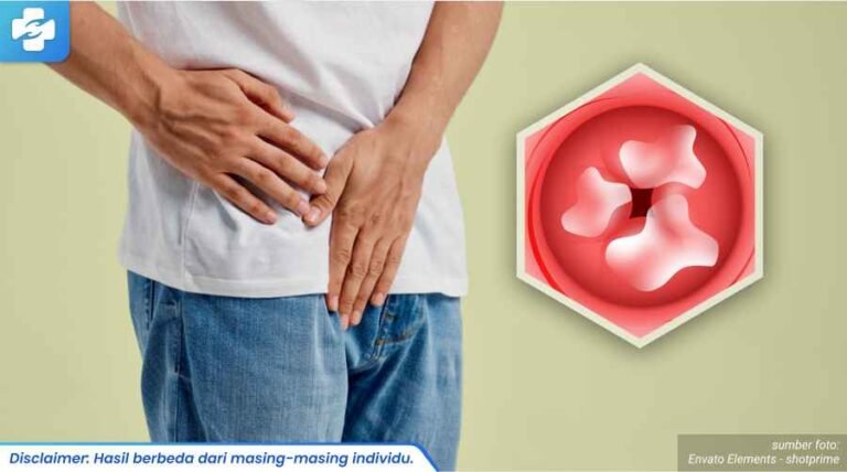 Infeksi Jamur di Selangkangan, Kenali 5 Tandanya! | Klinik Utama Apollo