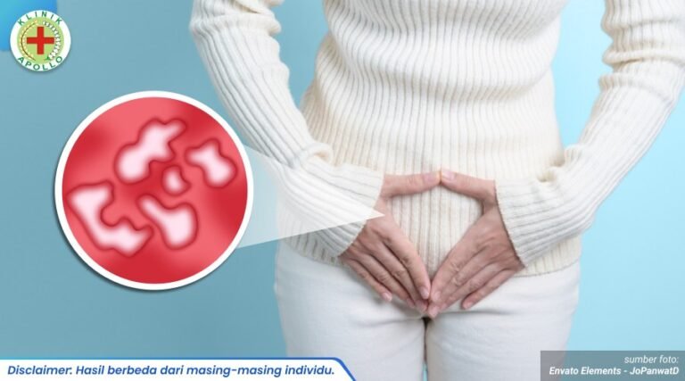 Ruam Melingkar di Selangkangan, Cek Pemicunya! | Klinik Utama Apollo